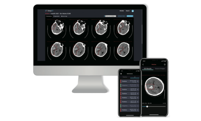 Deep01 - The Leader of AI Healthcare CiRCLELiNKS Channel